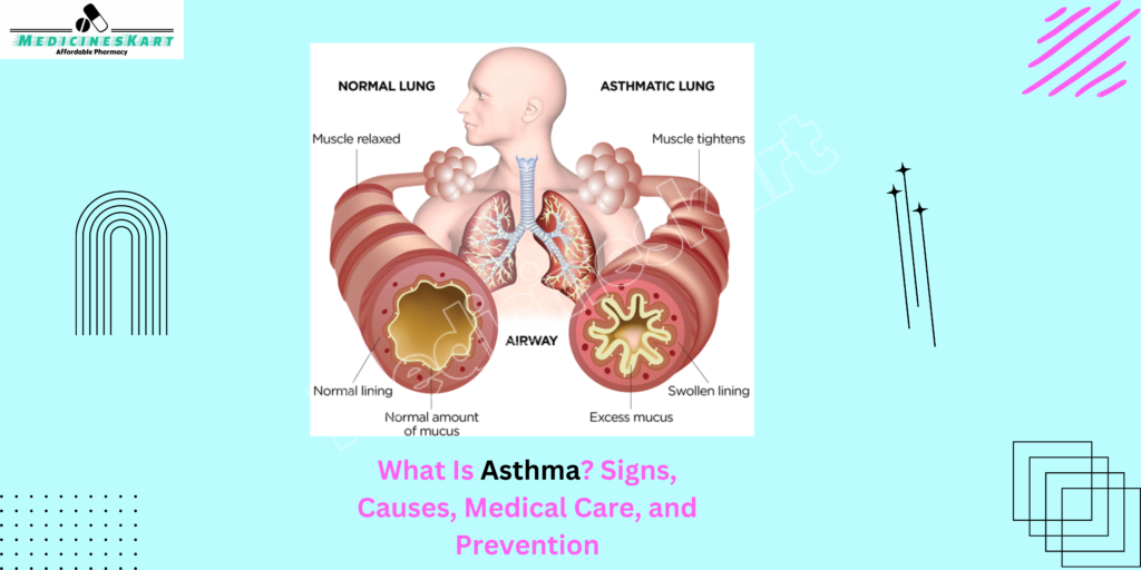 What Is Asthma? Signs, Causes, Medical Care, and Prevention ...
