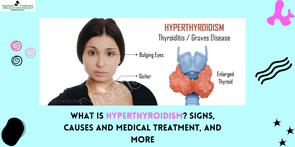 What Is Hyperthyroidism? Signs, Causes and Medical Treatment, and More ...